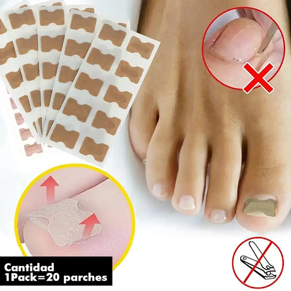 Corrector De Uñas Encarnadas Gradoimportado